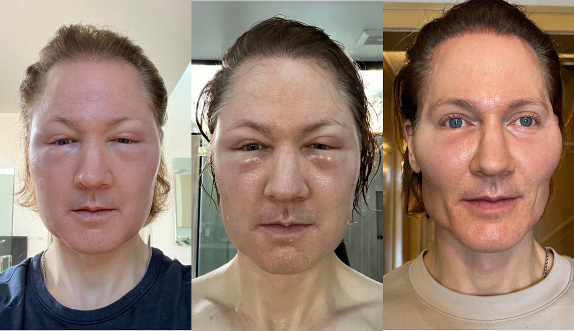 When Blueprint goes wrong – Blueprint Bryan Johnson